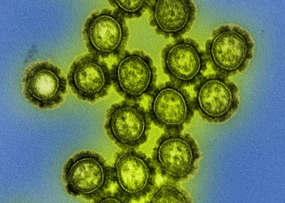 Descubiertos los pandoravirus